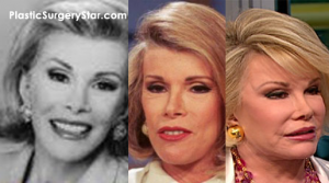 CELEB DRAMATIC PLASTIC SURGERY